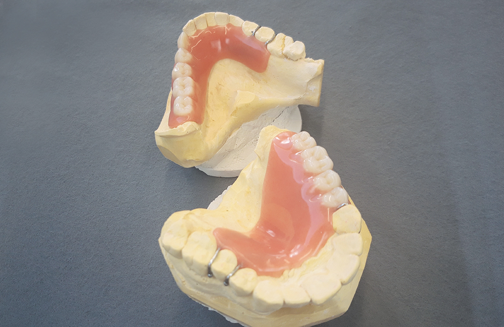 Dental-Labor Haas | KASSENLEISTUNGEN | Repertoire folgenden ...