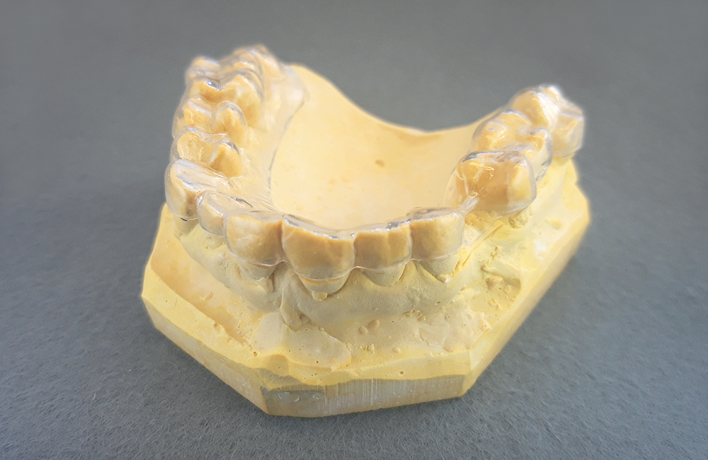 Dental-Labor Haas | KASSENLEISTUNGEN | Repertoire folgenden ...