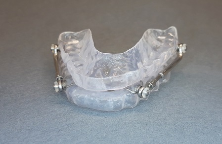 Schnarcherschiene | Ihr Zahntechniker | Dental-Labor Haas