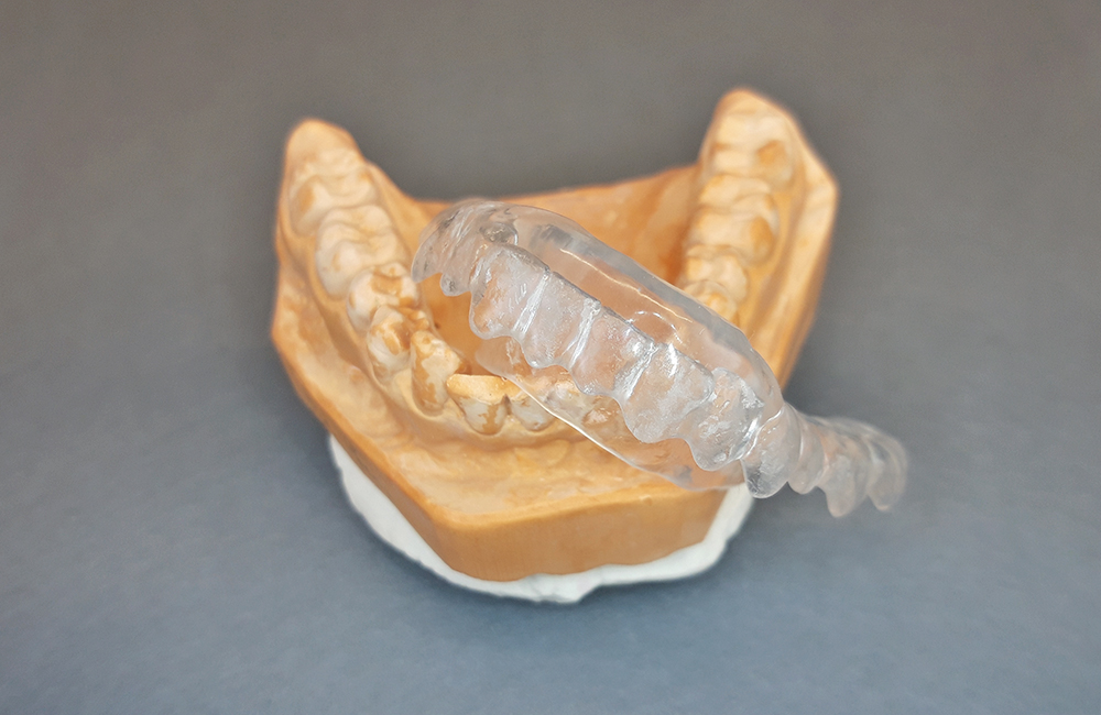 Knirscherschiene | Ihr Zahntechniker | Dental-Labor Haas