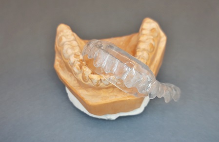 Knirscherschiene | Ihr Zahntechniker | Dental-Labor Haas