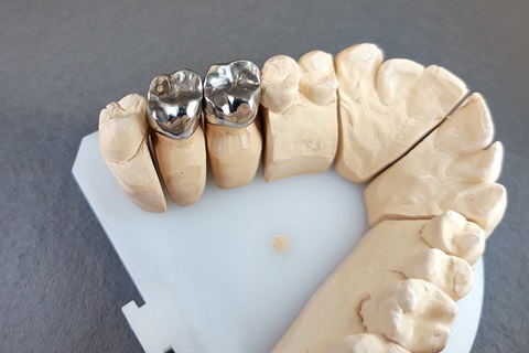 Dental-Labor Haas | KASSENLEISTUNGEN | Repertoire folgenden ...