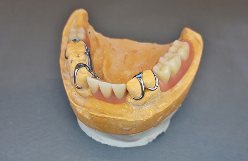 Dental-Labor Haas | KASSENLEISTUNGEN | Repertoire folgenden ...