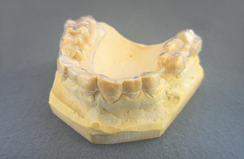 Dental-Labor Haas | KASSENLEISTUNGEN | Repertoire folgenden ...