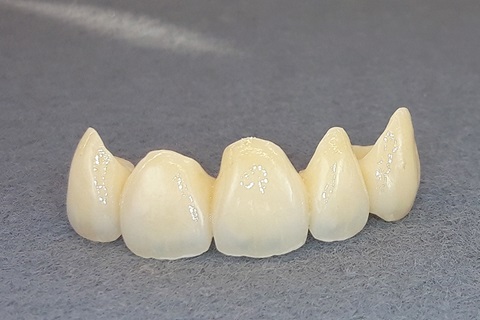 Dental-Labor Haas | PRIVATLEISTUNGEN | Ästhetische Ergebnisse sind uns ...